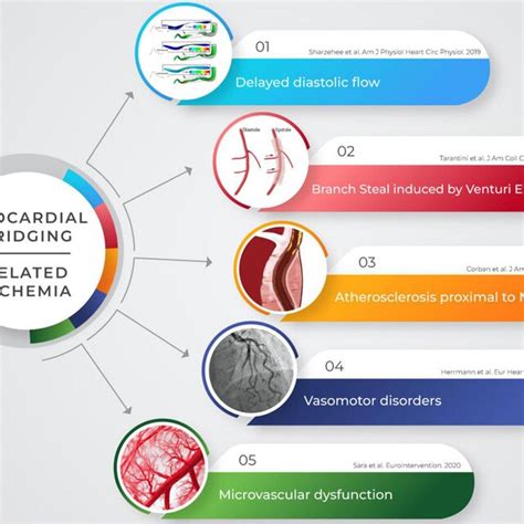 Myocardial Ischemia Is Not Purely Related To Vessel Systolic