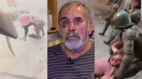 Adulto Mayor Golpeado Por Carabineros Procedieron De Forma Muy