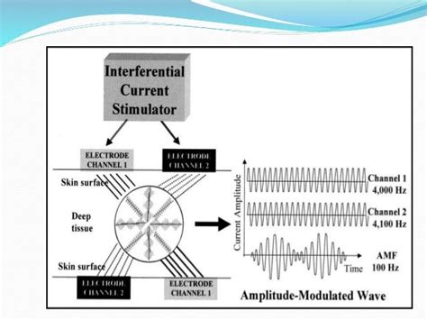 Interferential Current