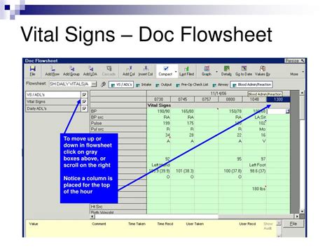Epic Flowsheet Template