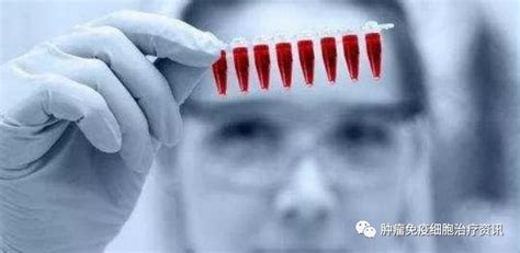 Car T细胞与实体瘤