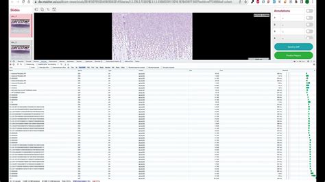 Postgresql MySQL 5 1 DicomWeb 1 14 Performance Improvements