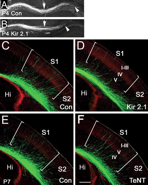 Activity Dependent Development Of Callosal Projections In The