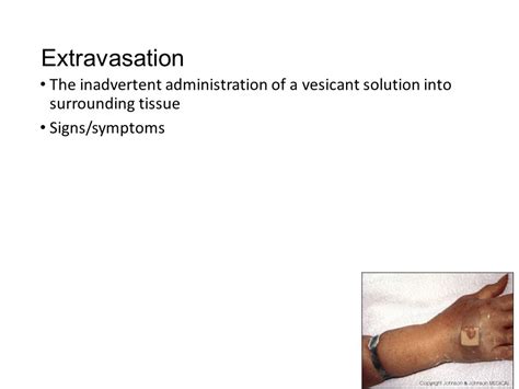 Iv Therapy Vema Sweitzer Mn Rn Ppt Video Online Download