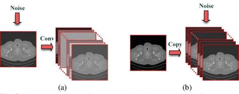 Figure 1 From Iterative Reconstruction For Low Dose Ct Using Deep Gradient Priors Of Generative