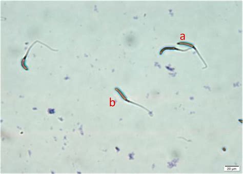 Sperm Acrosome Morphology After Freezing 400 × Observation Under