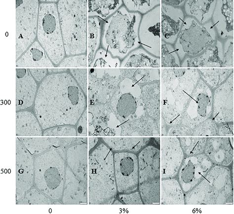 Transmission Electron Micrographs Of Ultrathin Sections Of Cells From Download Scientific