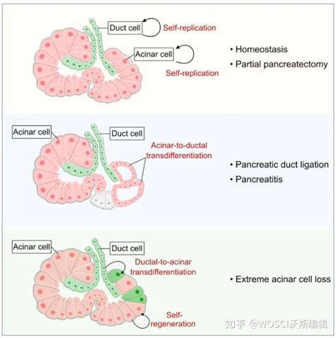 Cd（if 38） 中国科学院揭开成人胰腺中外分泌细胞命运转换的奥秘 知乎