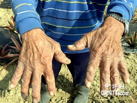 香港中評網：中評鏡頭：鳳梨伯務農68年結繭風霜大手