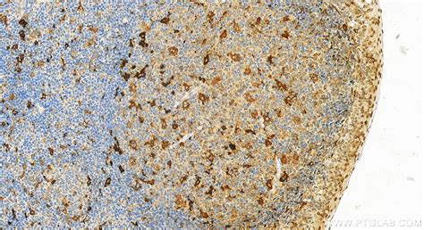 Cd83 Antibody 32149 1 Ap Proteintech