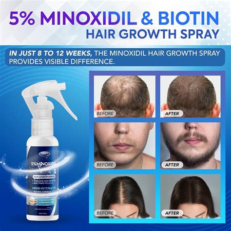 Minoxidil 5 Spray 60ml For Men And Women