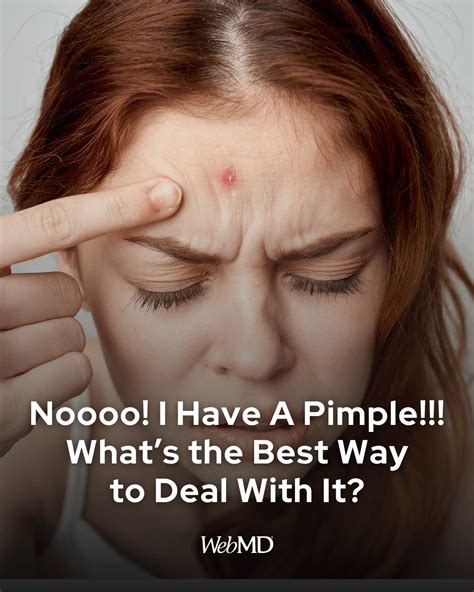 Webmd A Board Certified Dermatologist Shares Her Tips To Control And