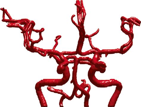 3d Vascular Tree Of The Segmentation Results On Cerebral Mra Dataset Download Scientific