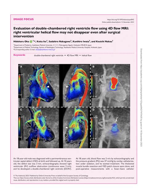 Pdf Evaluation Of Double Chambered Right Ventricle Flow Using 4d Flow Mri Right Ventricular