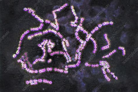 Group A Streptococci Pyogenes Bacteria Light Micrograph Stock Image C061 0037 Science