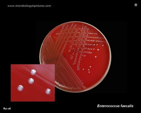 Enterococcus Spp