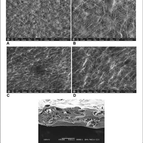 Scanning Electron Microscopy Sem Results Of Composite Membrane Download Scientific Diagram