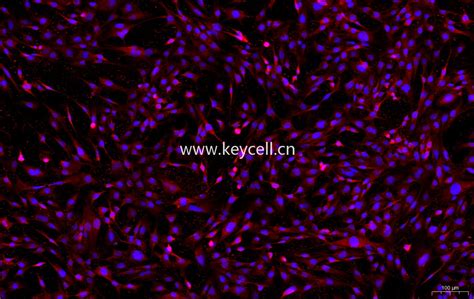 人软骨细胞永生化（免疫荧光鉴定） 细胞系 细胞库 旗赛生物科技（武汉）有限公司