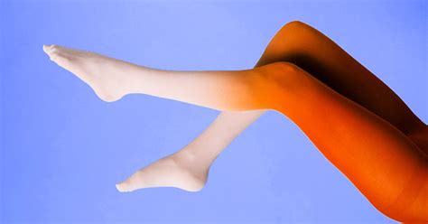 Cellulitis Explained