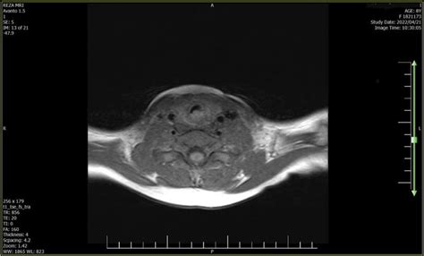 Present The Mri Images Which Reveal A Multiloculated Nodular Lesion In Download Scientific