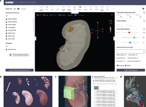 Tissue Registration User Interface Rui A Tissue Registration For Download Scientific Diagram