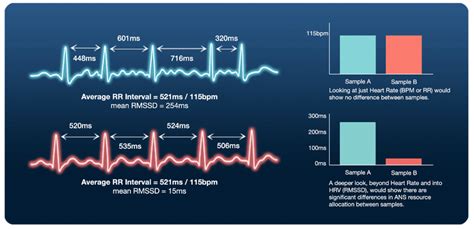 example of r r intervals in milliseconds duration between r peaks from