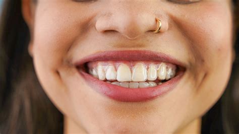 Popular Questions About Invisalign Answered Smile By Design Va