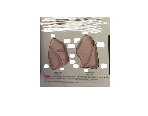 Lateral Lung Quiz