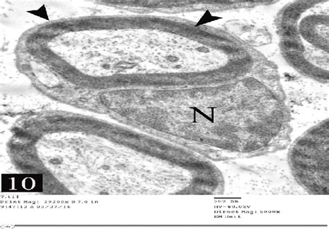 A Photomicrograph Of An Ultrathin Section Of Sciatic Nerve From A