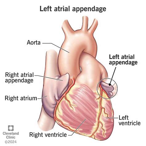 Left Atrial Appendage Laa