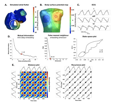 A Illustration Of A Simulated Atrial Flutter Around The Tricuspid Download Scientific Diagram