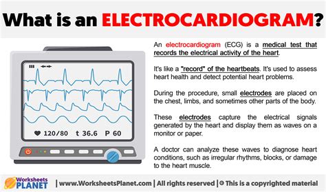 What Is An Electrocardiogram