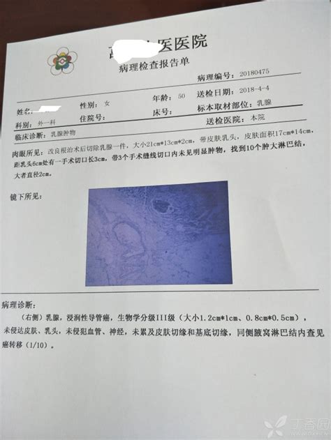 女51岁查体病理结果已公布 丁香园论坛