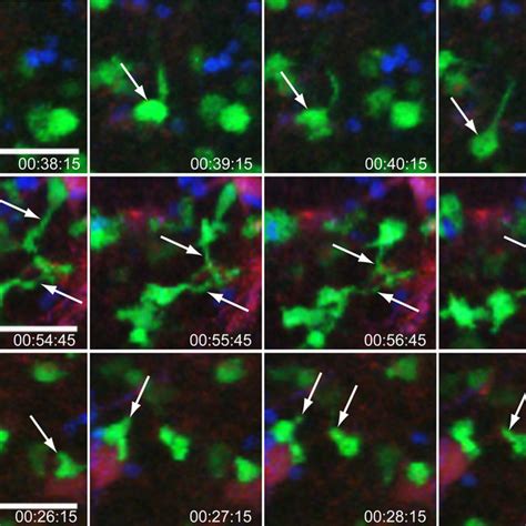 Morphology Of GC And Examples Of GC B Cells As Imaged By Intravital Download Scientific Diagram