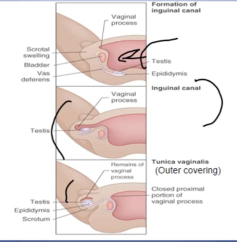 STRUCTURE AND FUNCTION OF MALE REPRODUCTIVE SYSTEM Patho Renal