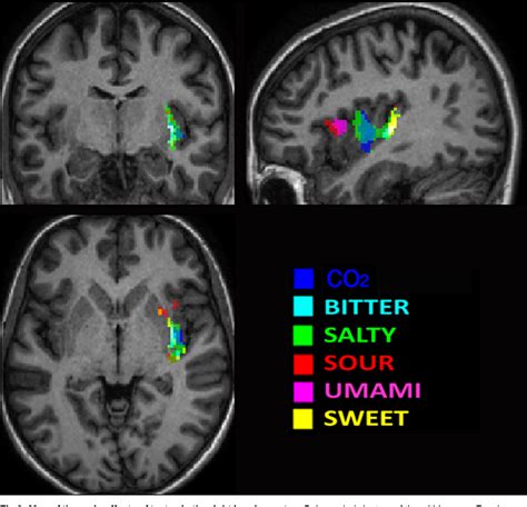 Gustatory Cortex