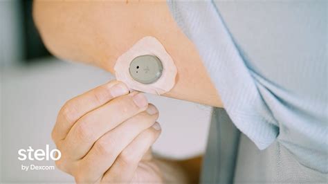 How Do I Remove And Replace My Stelo Glucose Biosensor Stelo By Dexcom