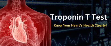 Troponin T Test Why Its Done Normal Range And How To Prepare
