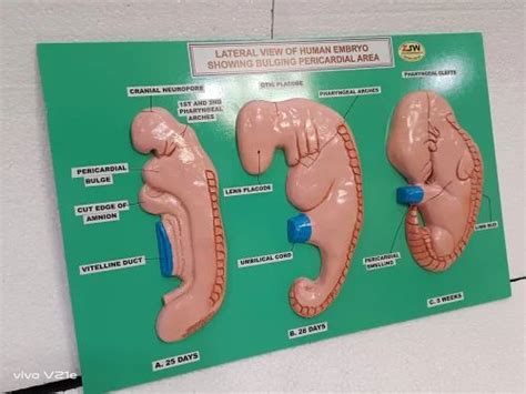 Lateral View Of Human Embryo Showing Bulging Pericardial Area At ₹ 3250