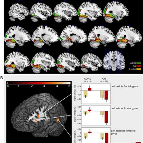 Modified Visual Oddball Task Download Scientific Diagram