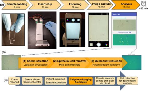 A Confirmatory Test For Sperm In Sexual Assault Samples Using A