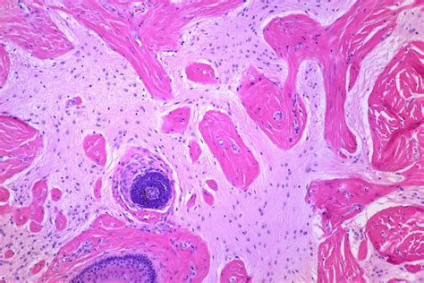 Judy Melinek Md On Twitter Rt Geronimojrlapac A Rare Case Since Judy Melinek Md On Twitter Rt Geronimojrlapac A Rare Case Since