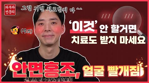 안면홍조 없애는 법 🔥 피부과 가기 전👀먼저 해보세요 모세혈관확장 주사피부염치료 Youtube