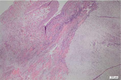 Wright And Giemsa Stain Demonstrating Fusiform Spindle Cells With Download Scientific Diagram