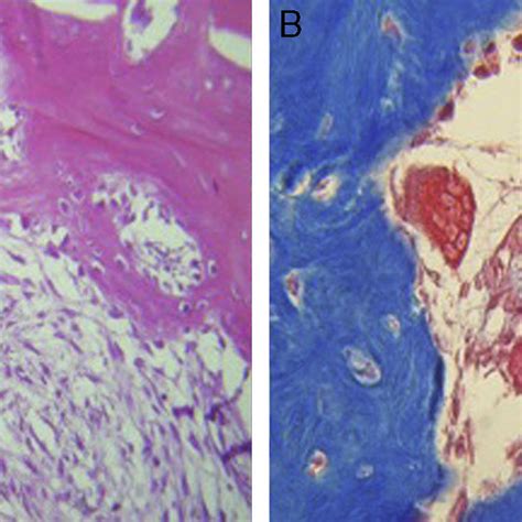 Tinciones Histológicas Con Hematoxilina Y Eosina Y Tricrómico De