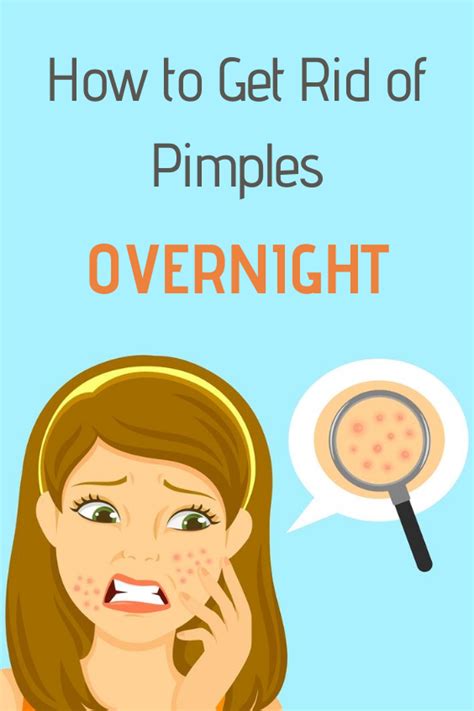 How To Get Rid Of Pimples Overnight