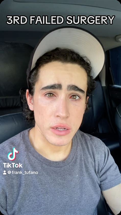 Frank Tufano Drtaban Tabanmd Botched Instagram