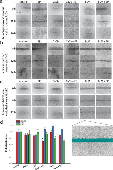 Reduced Migration Potential Of Huvec Endothelial Cells After Caep Or