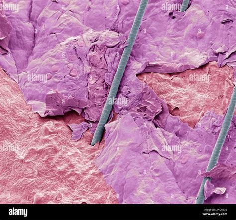 Foetal Skin Coloured Scanning Electron Micrograph Sem Of Skin On The Scalp Of A Human Foetus