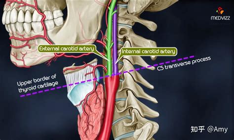 颈内动脉的8种分段系统 知乎